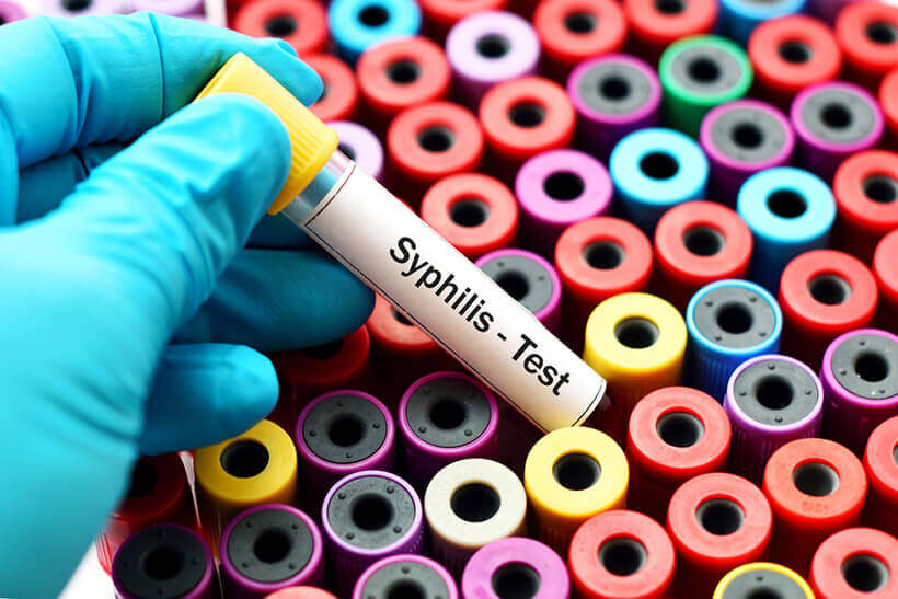 Best Syphilis Tests Of 2019 (UPDATED Nov. 2019)